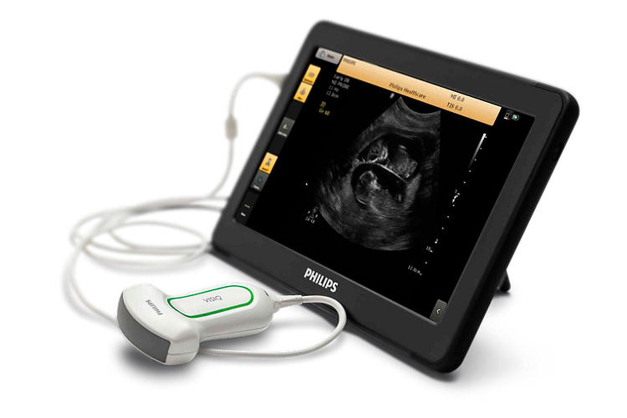 Philips VISIQ – innowacyjne USG w tablecie - Puls Biznesu - pb.pl